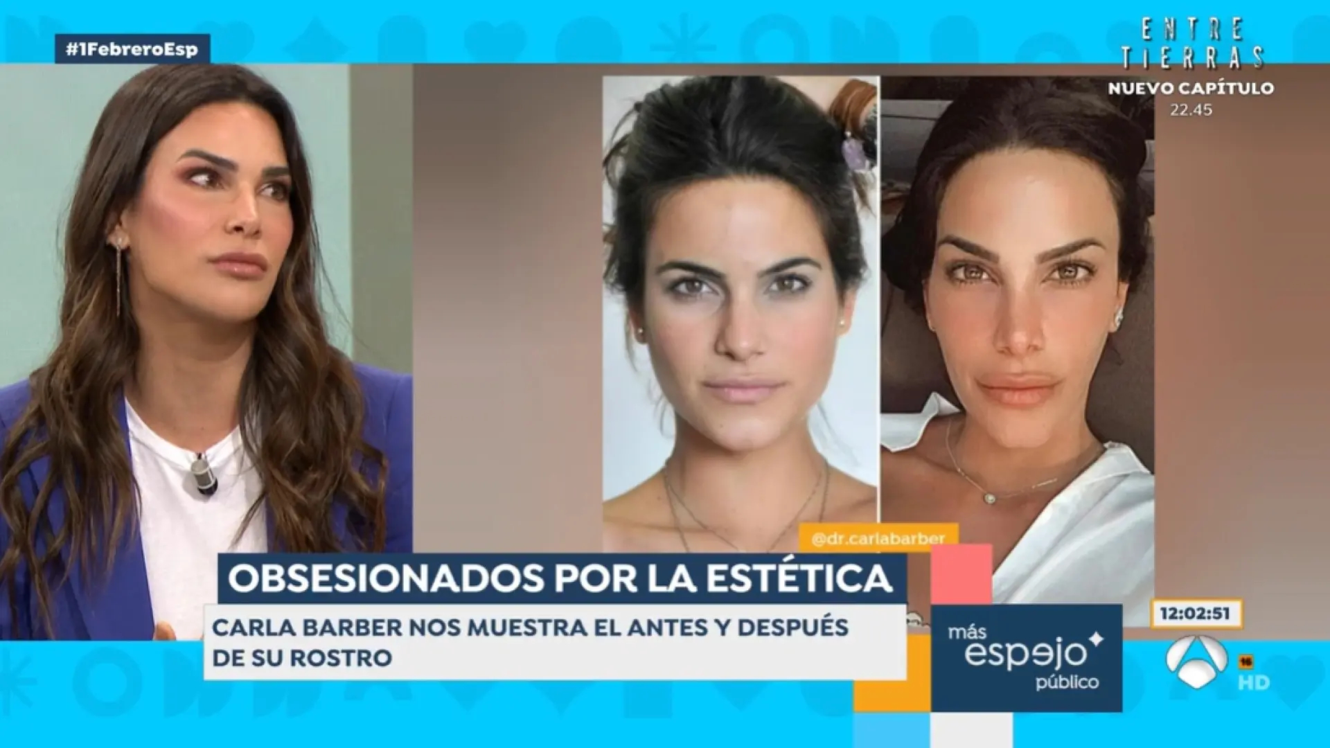 Carla Barber, la cirujana de los famosos, muestra el antes y después de ...