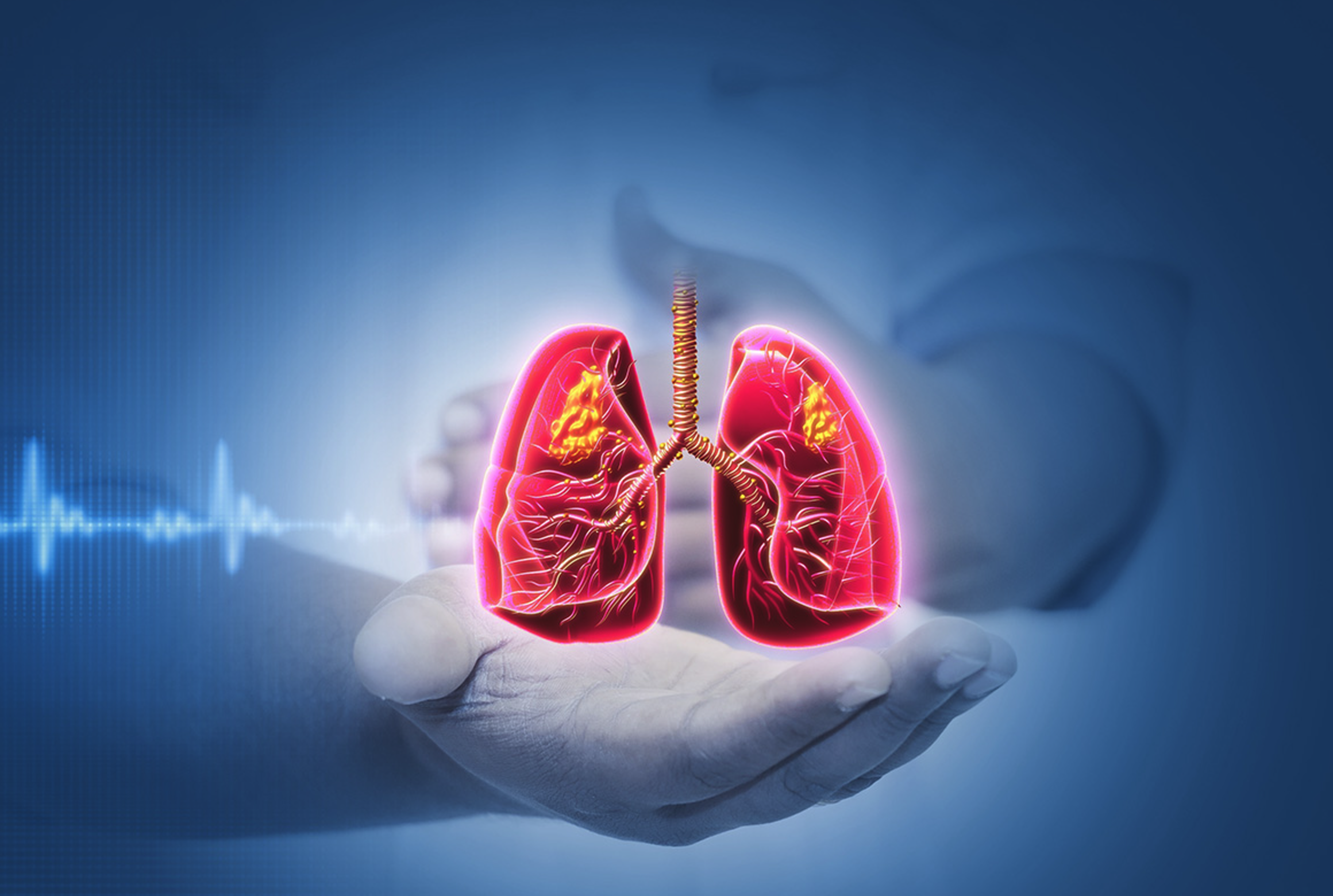 Cáncer de pulmón: cuando el diagnóstico no es el final, sino el ...